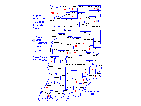 Tuberculosis 1999